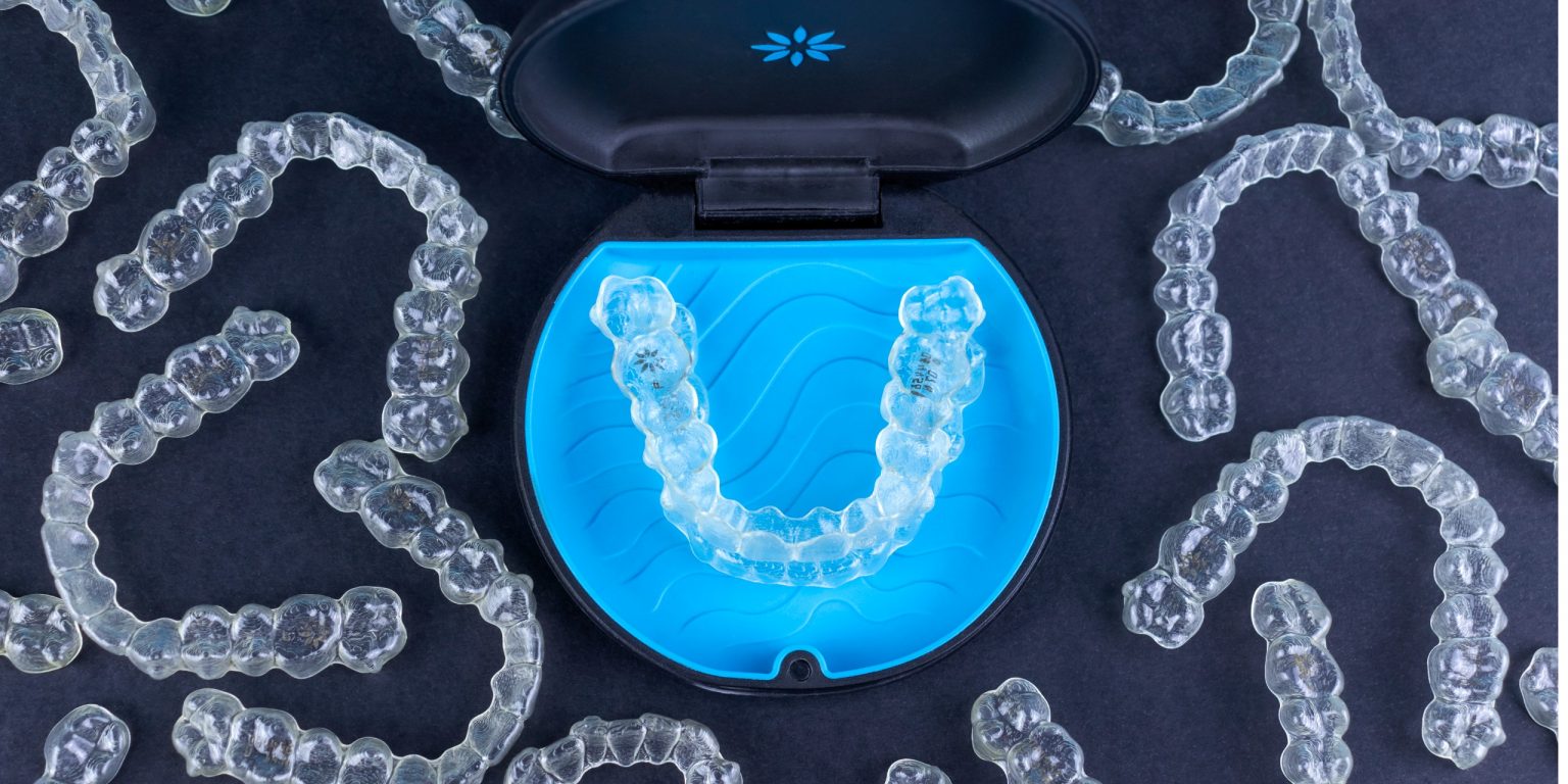 Zahnschiene: Viele Einsatzgebiete? - Team Dental